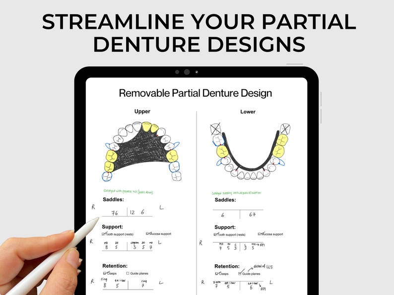 RPD Design Template: Printable Guide for Dentists & Students (PDF) - Etsy
