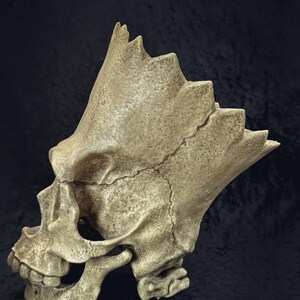 Bart Simpson Skull (full Sized) - Etsy