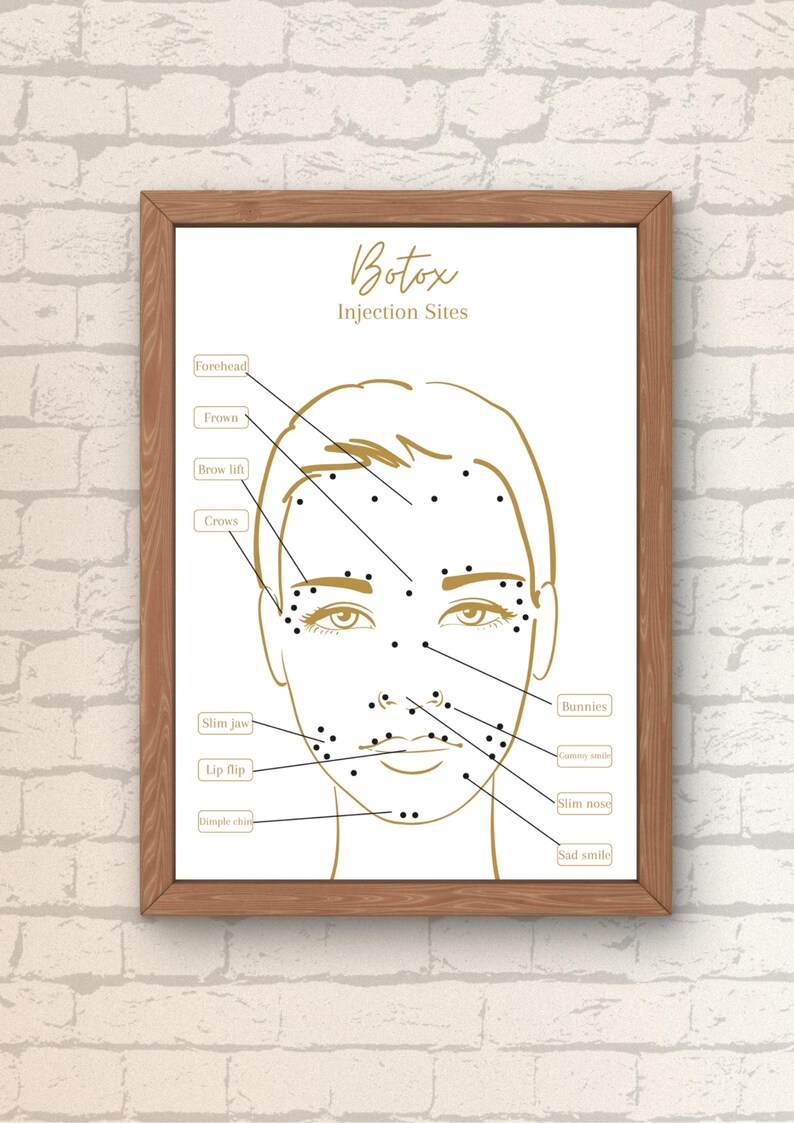 Botox Injection Sites - Etsy