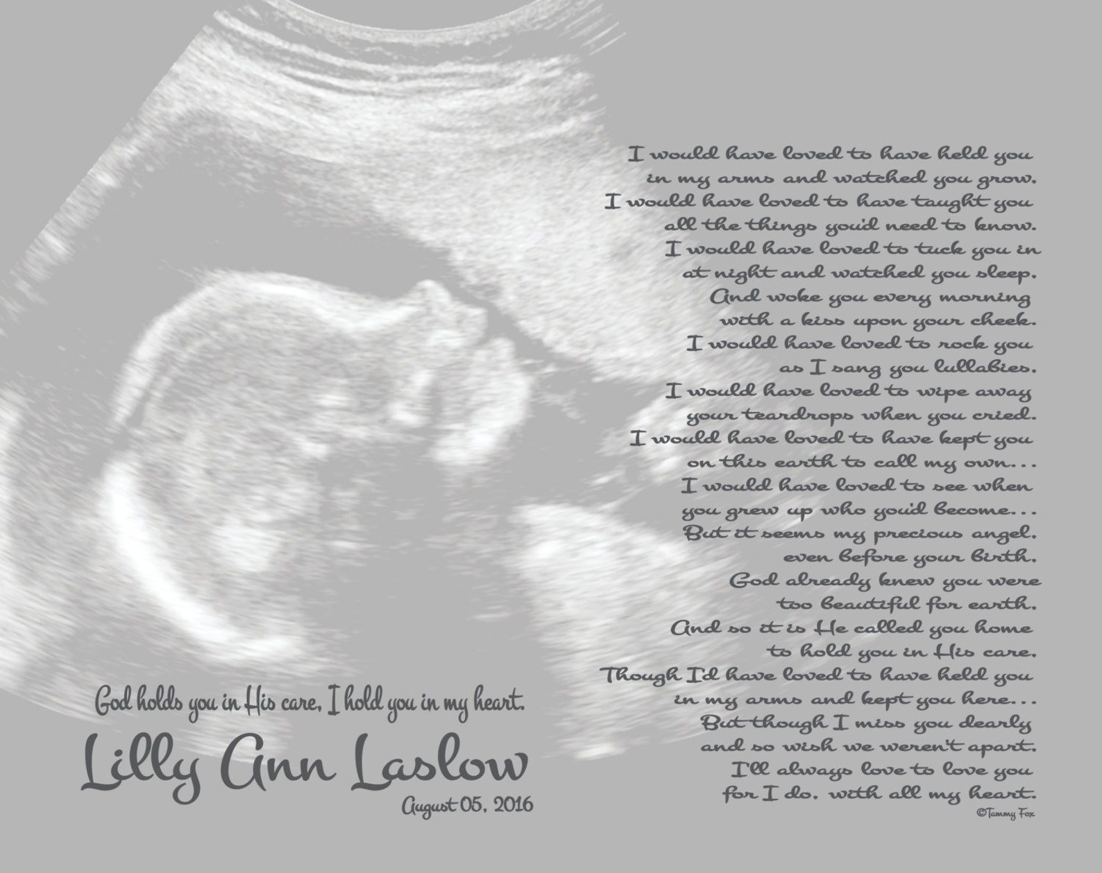 Miscarriage Remembrance Photo Print-miscarriage Sympathy Gift ...