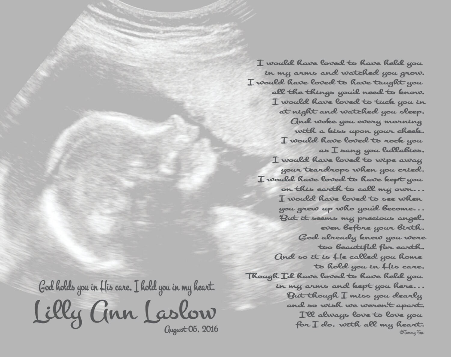 Miscarriage Remembrance Photo Print-miscarriage Sympathy Gift ...