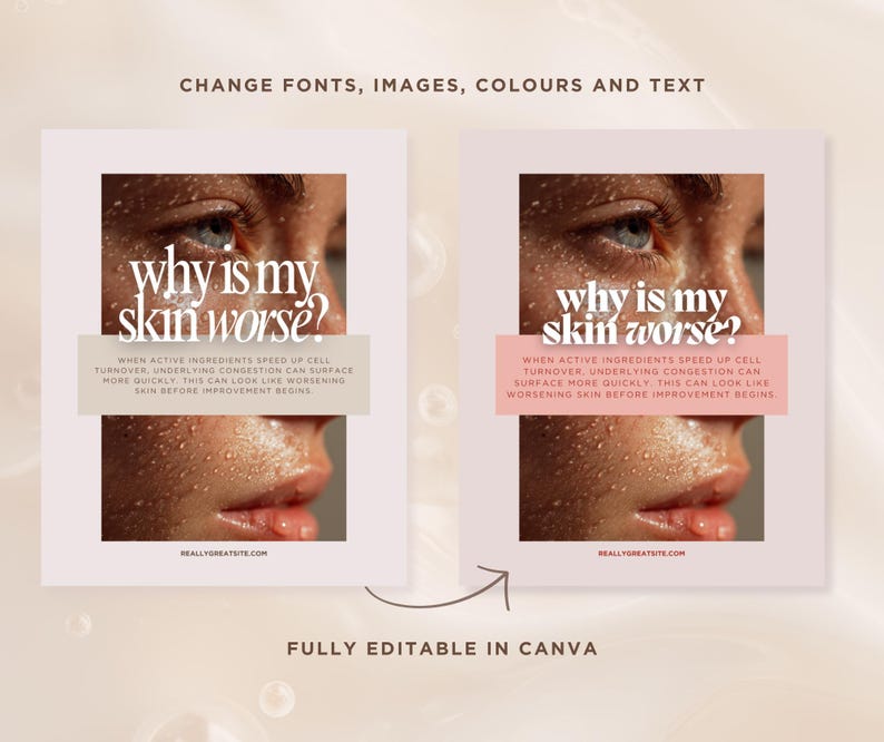 Skincare Social Media Templates | Canva Content Pack for Beauty ...