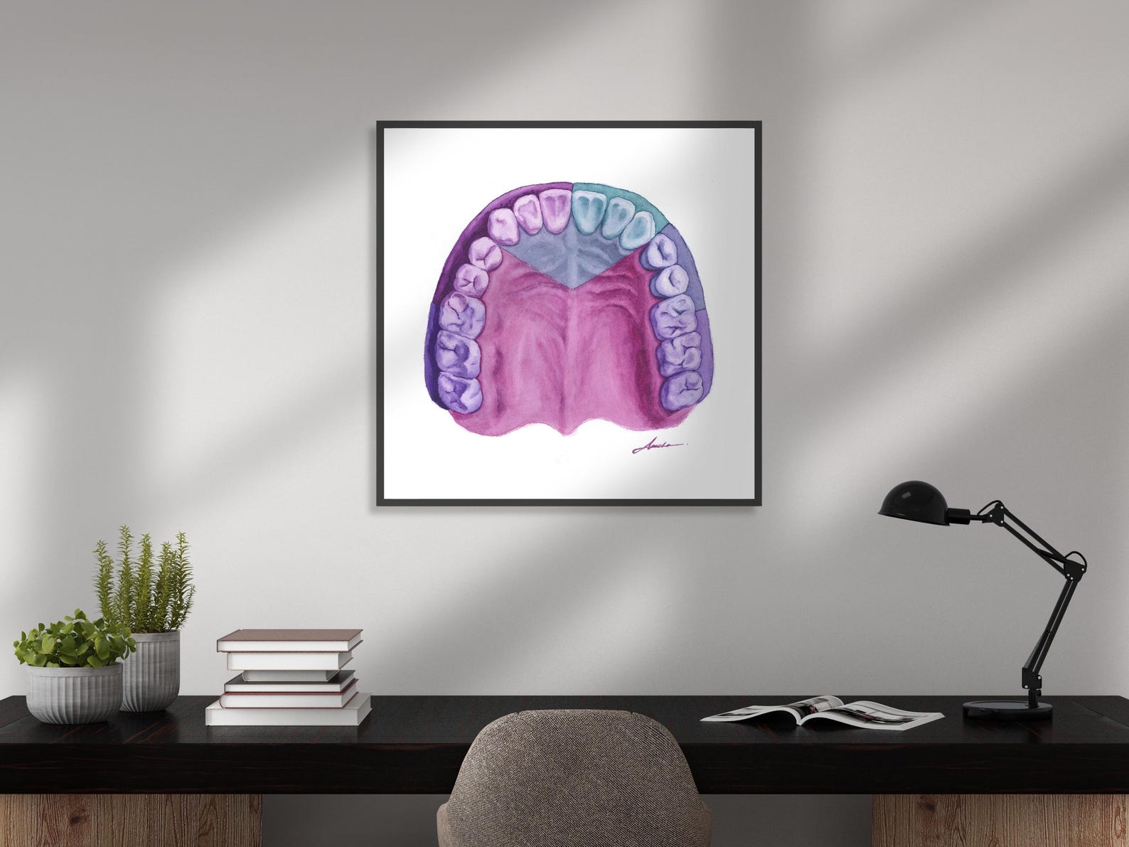 Dental Art Print: Pink Maxillary Nerve Blocks Watercolor - Dentist ...