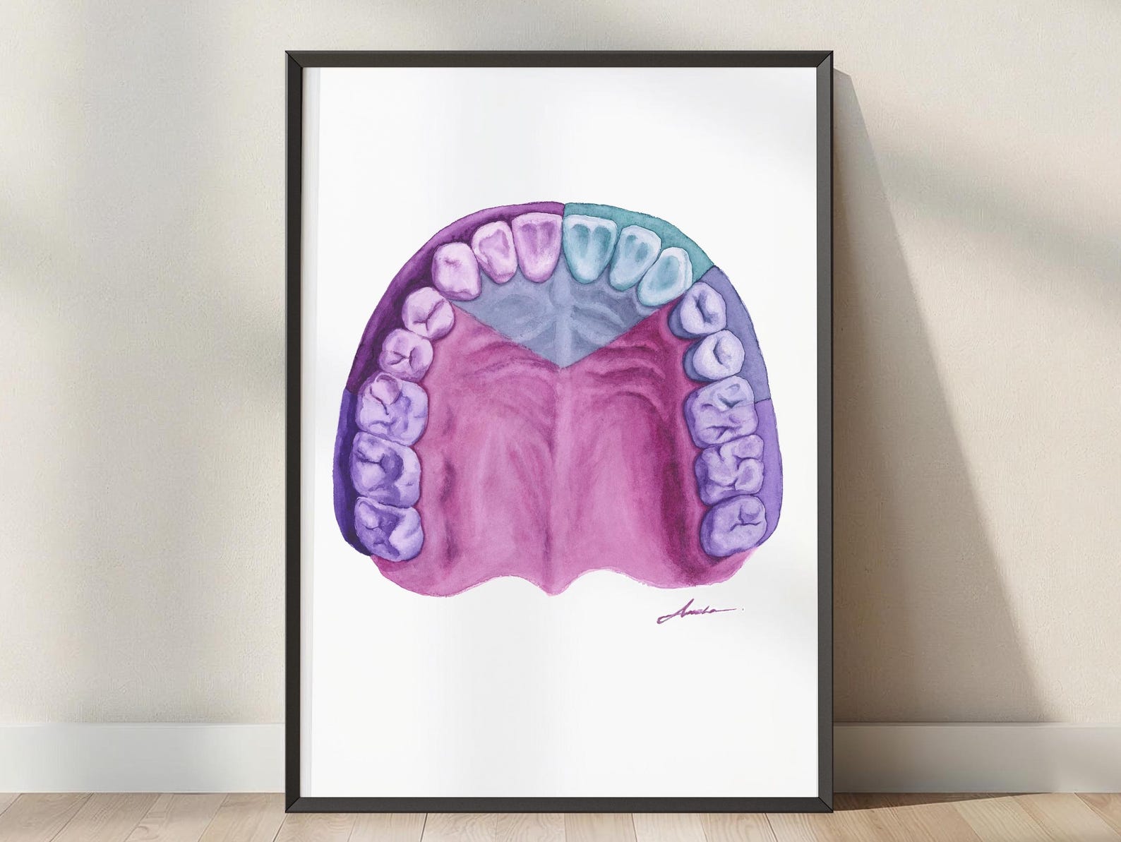 Dental Art Print: Pink Maxillary Nerve Blocks Watercolor - Dentist ...