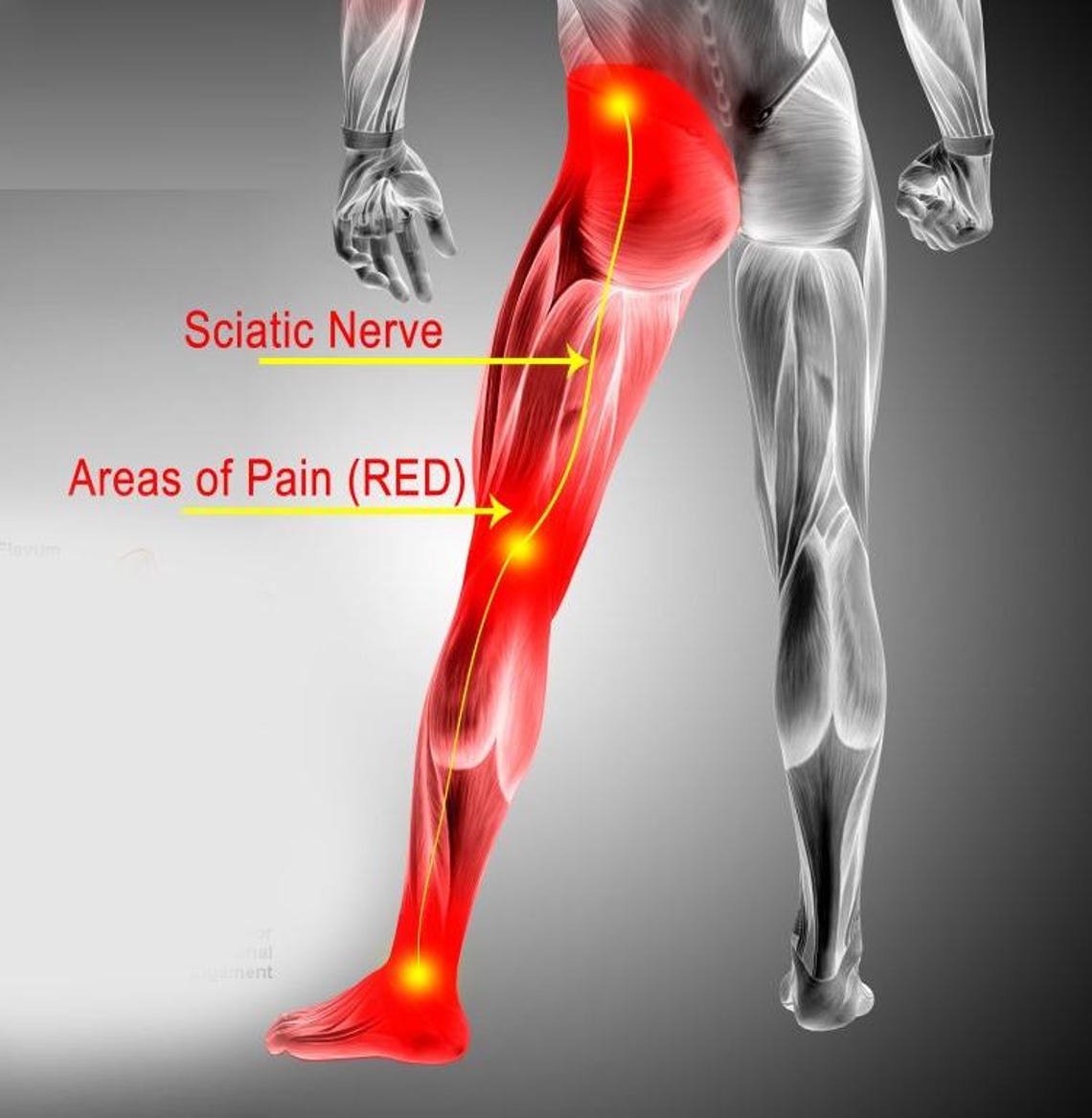 7-day Sciatica Stretching Guide | Relief for Back Pain & Tight Hips ...