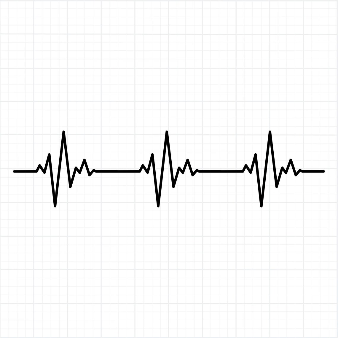 Heartbeat Line SVG PNG | Minimalist EKG Pulse Cut File | Medical Nurse ...