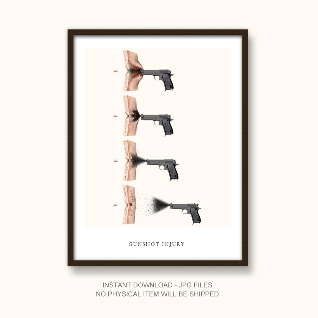 Gunshot Injury Anatomy Poster: Forensic Medical Illustration (JPG ...