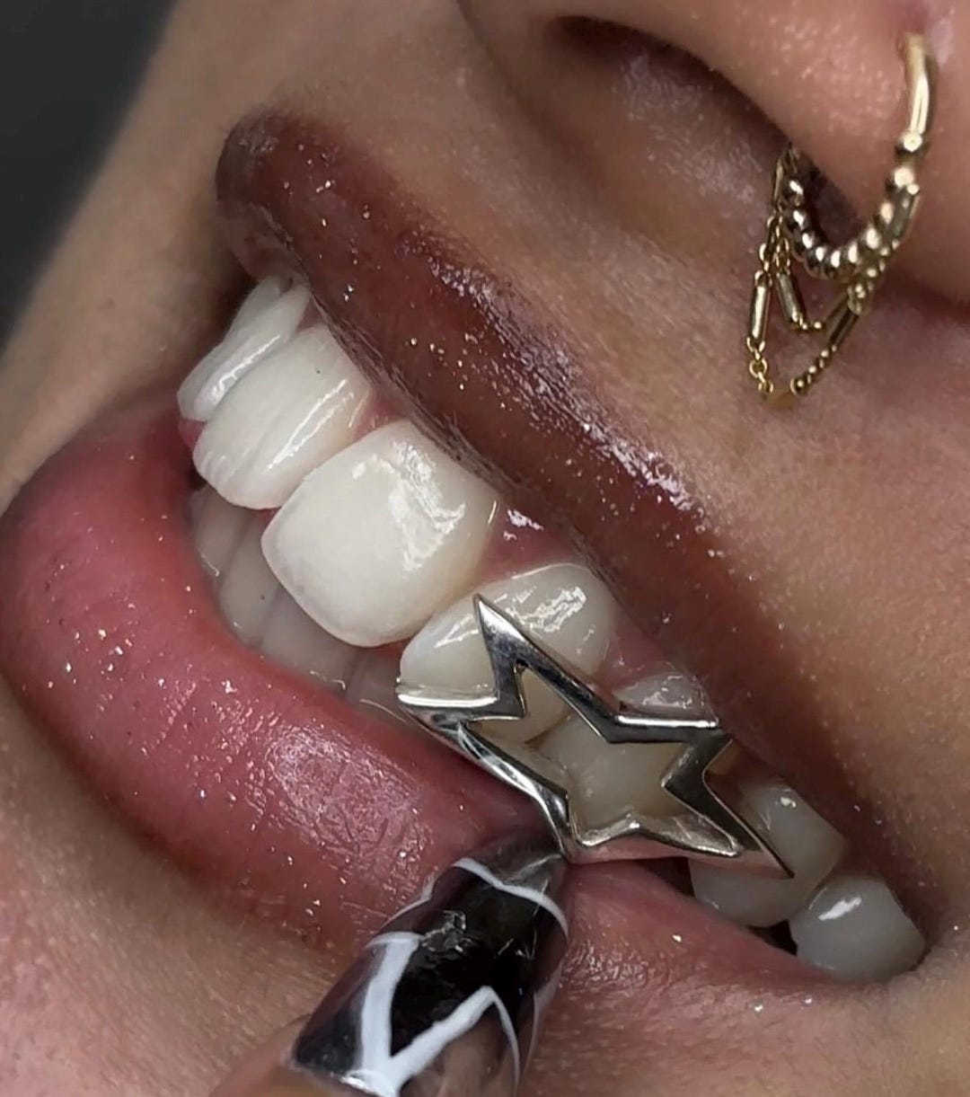 Star Window Cap Dental Gold & Silver Custom Made Grillz — Handmade ...