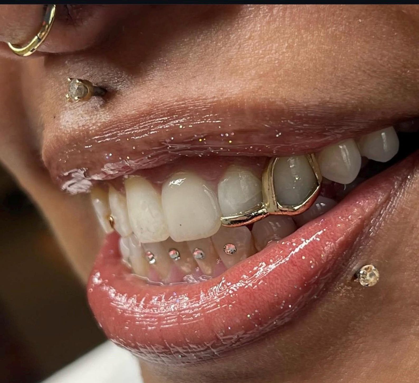 Window Inlay Tip Cap in Dental Gold & Sterling Silver Custom Made ...