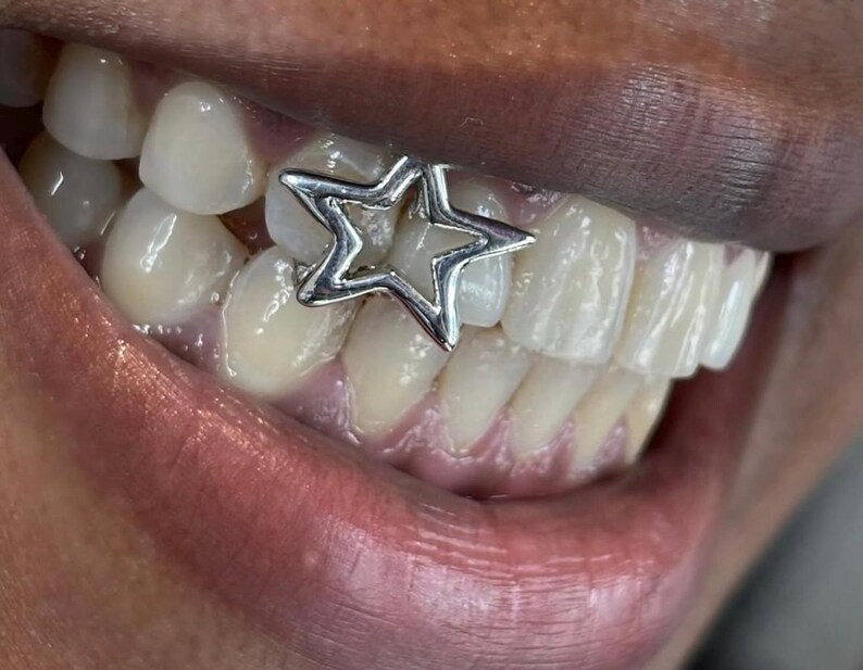 Star Window Cap Dental Gold & Silver Custom Made Grillz — Handmade ...