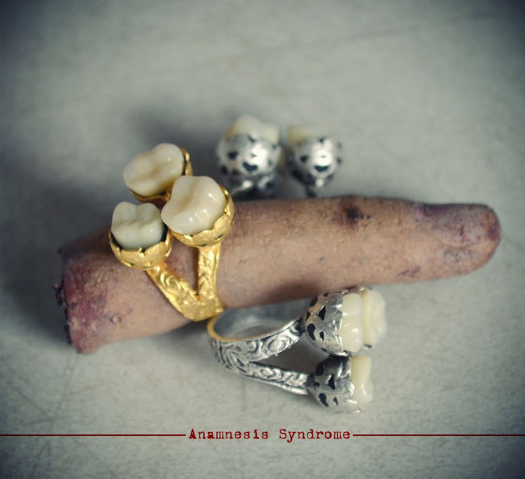 Golden Ring "tri Dents" With Human Molars (in Resin) - Etsy