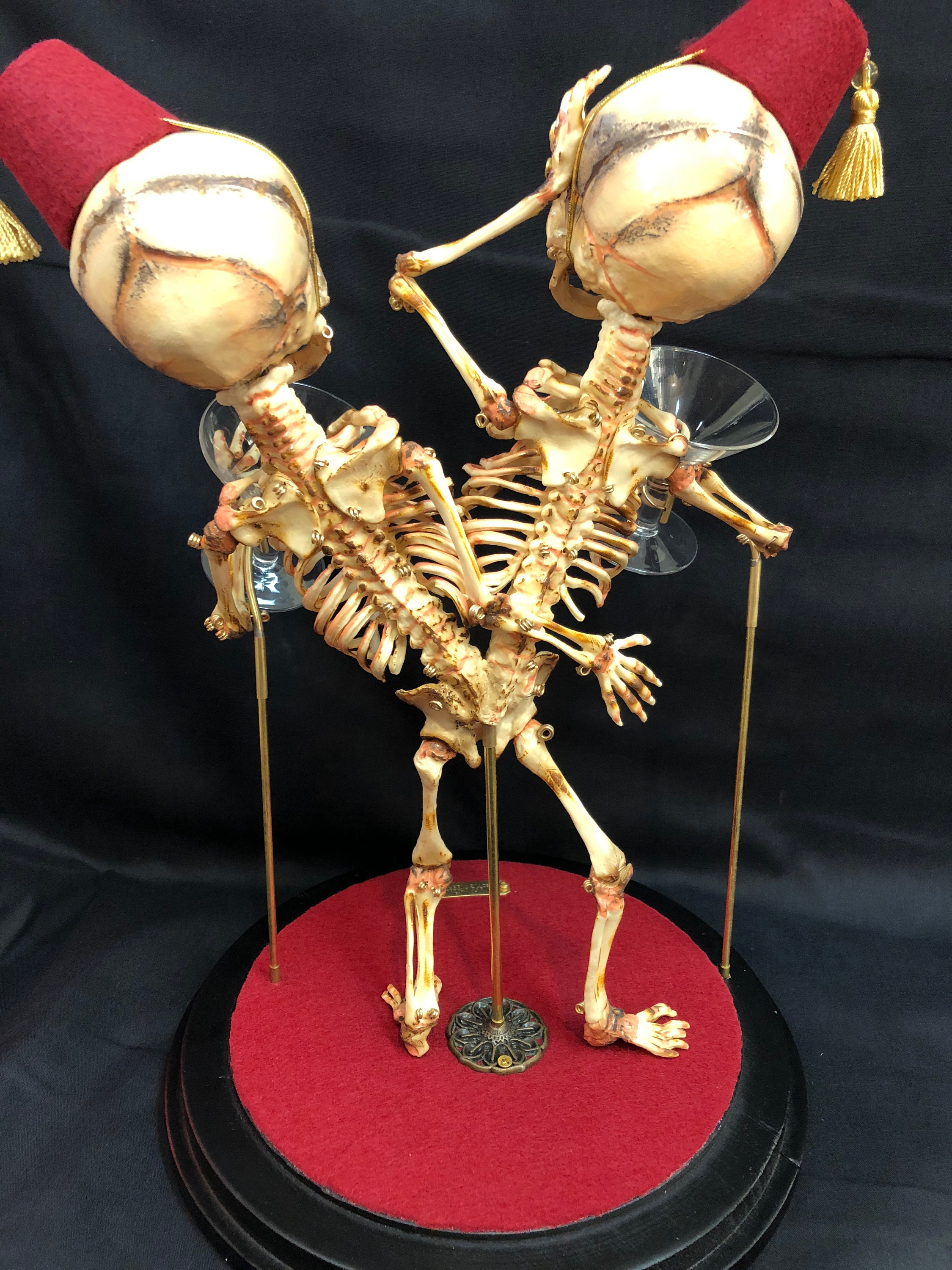 Conjoined Twin Skeleton
