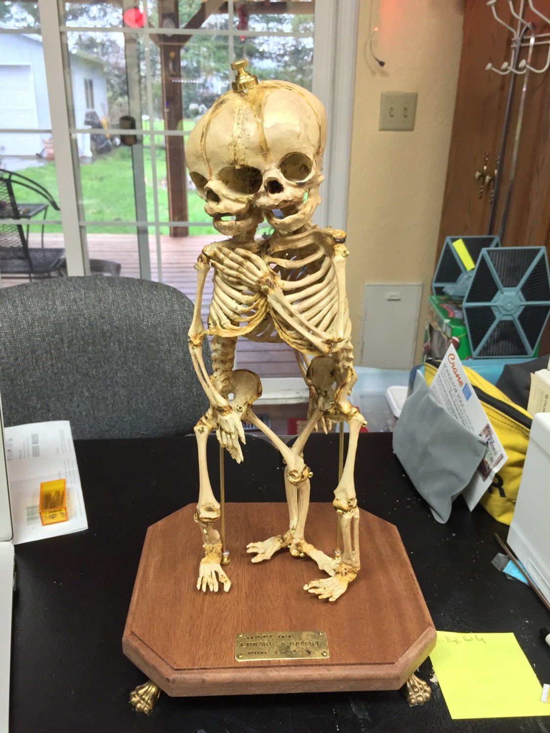 SALE Conjoined Twins Siamese Fetal Skeletons - Etsy