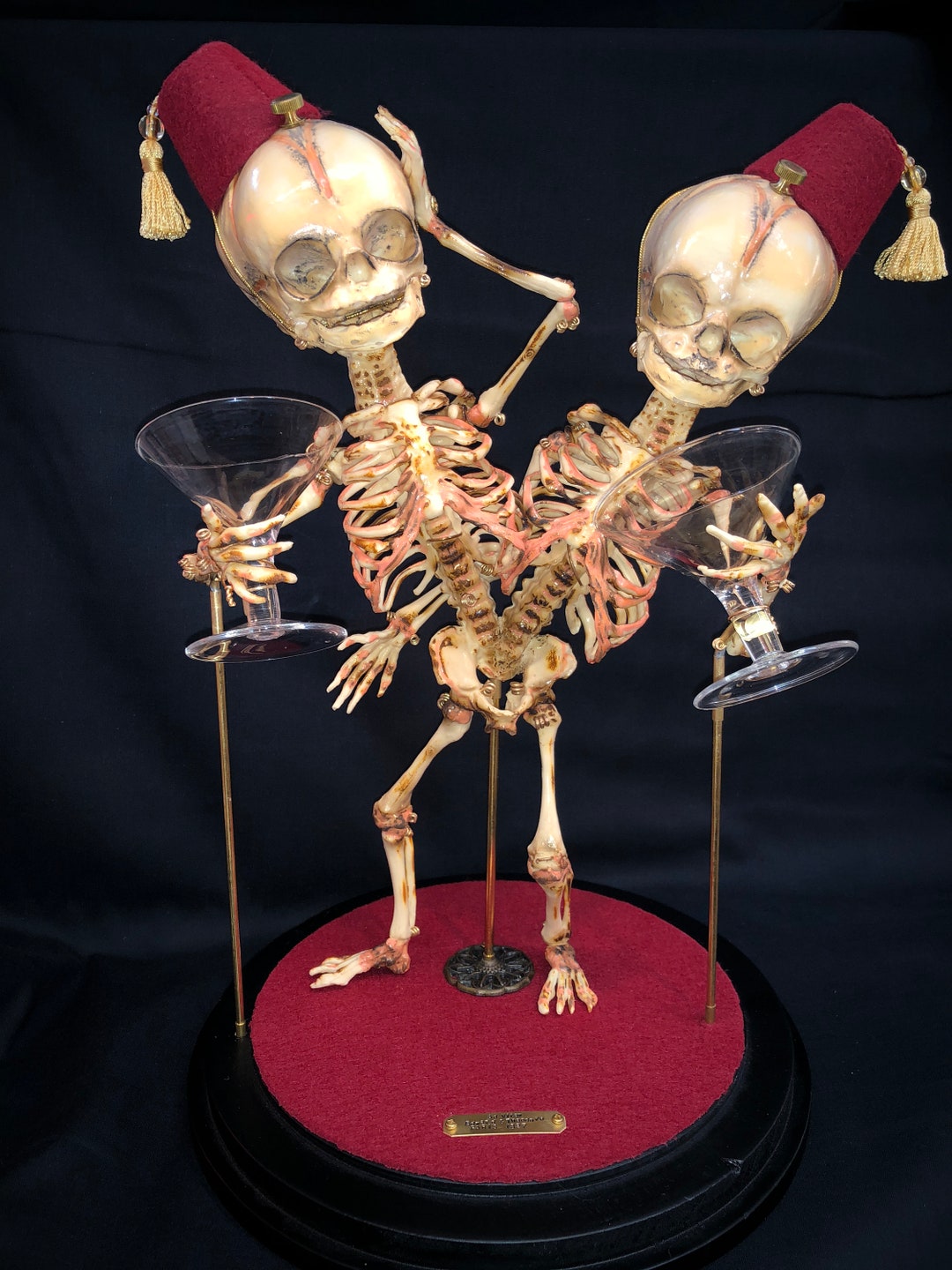 SALE Conjoined Twins Siamese Fetal Skeletons - Etsy