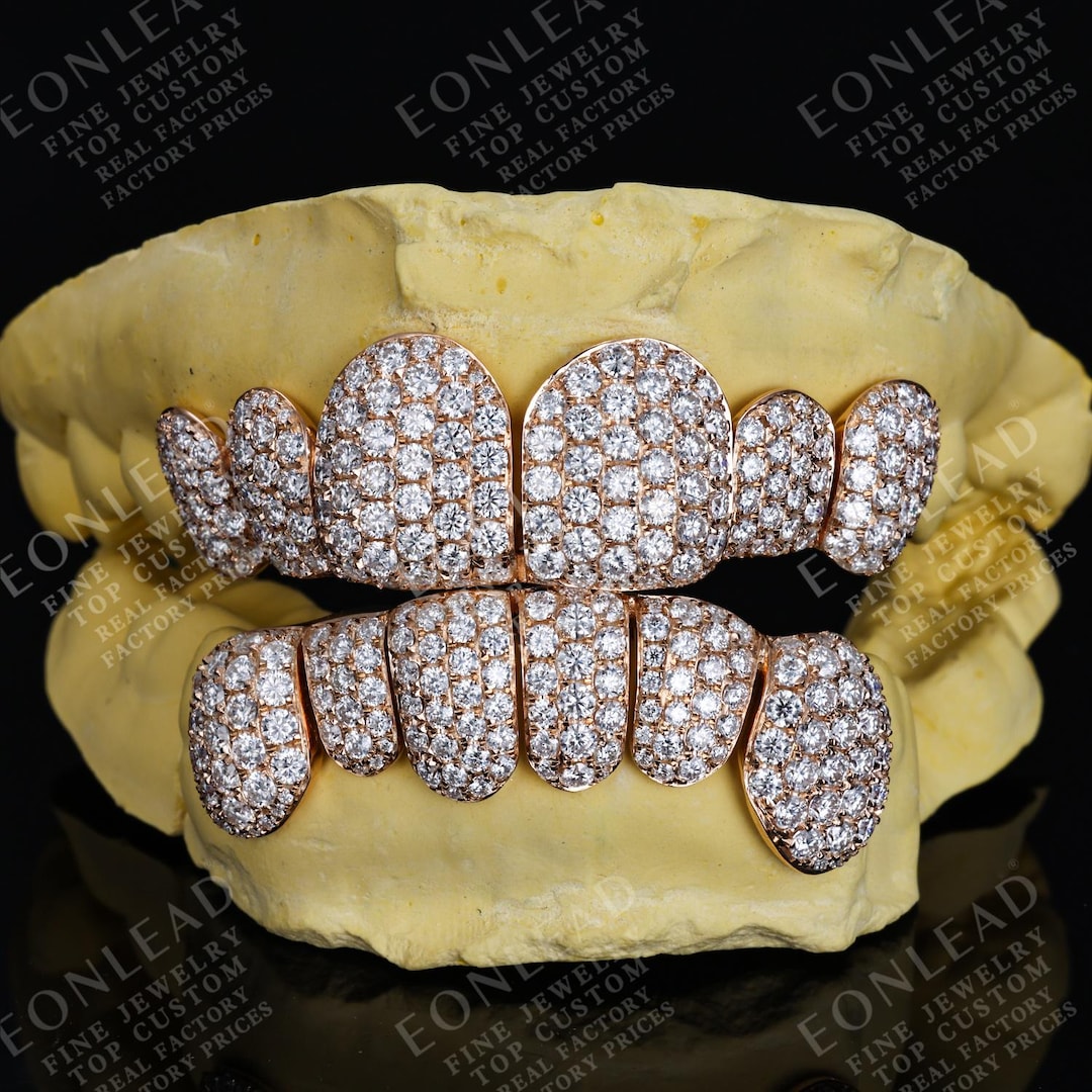Custom Top and Bottom 4 6 8 10 12 Rose Gold Plated Diamond Grillz for ...