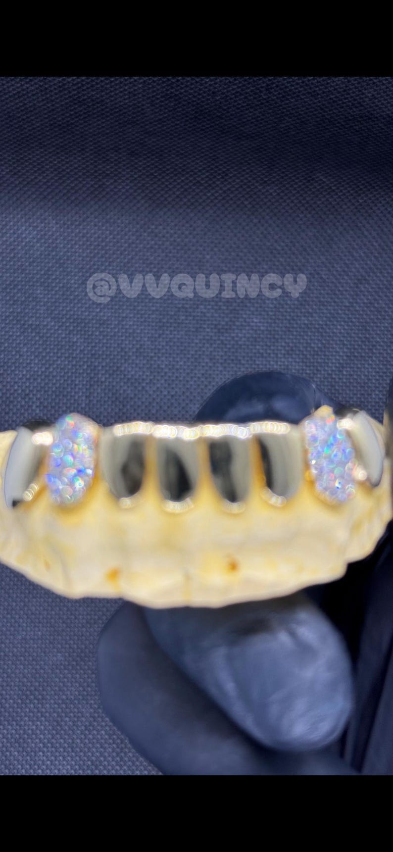 VVS Custom Gold Grillz - Etsy