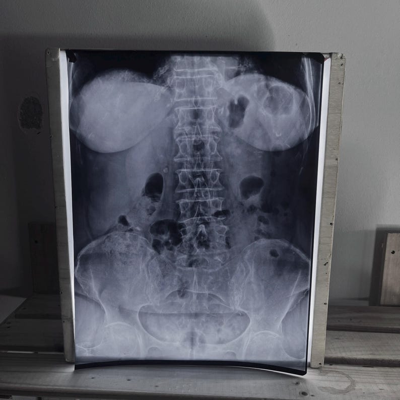 Authentic Retro X-ray Radiography Films – 14x17 Inch - Etsy