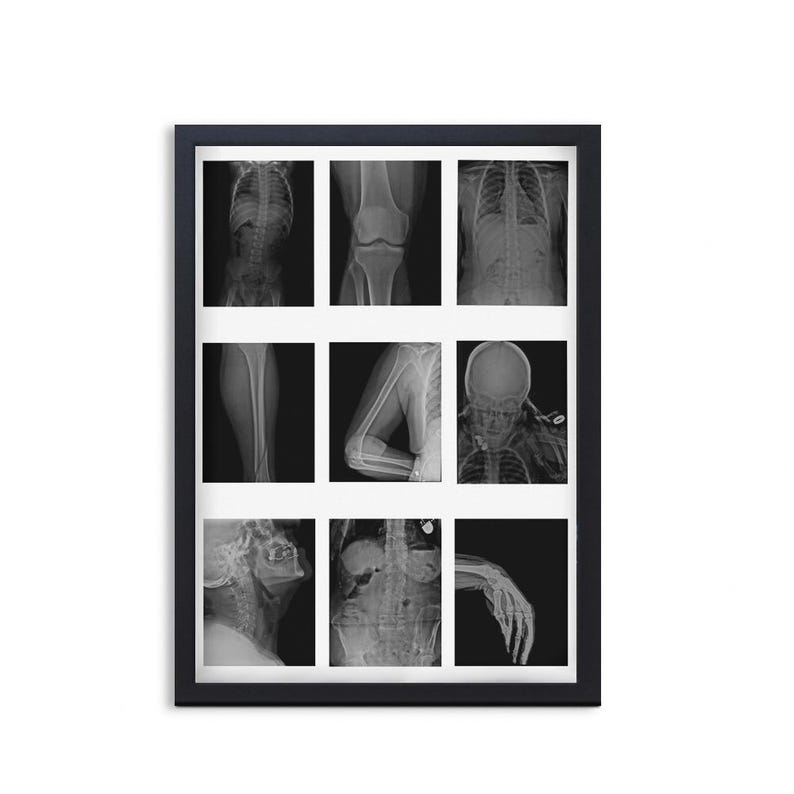 Skeleton X-ray Printable Art | Digital Collage of Radiology Samples ...