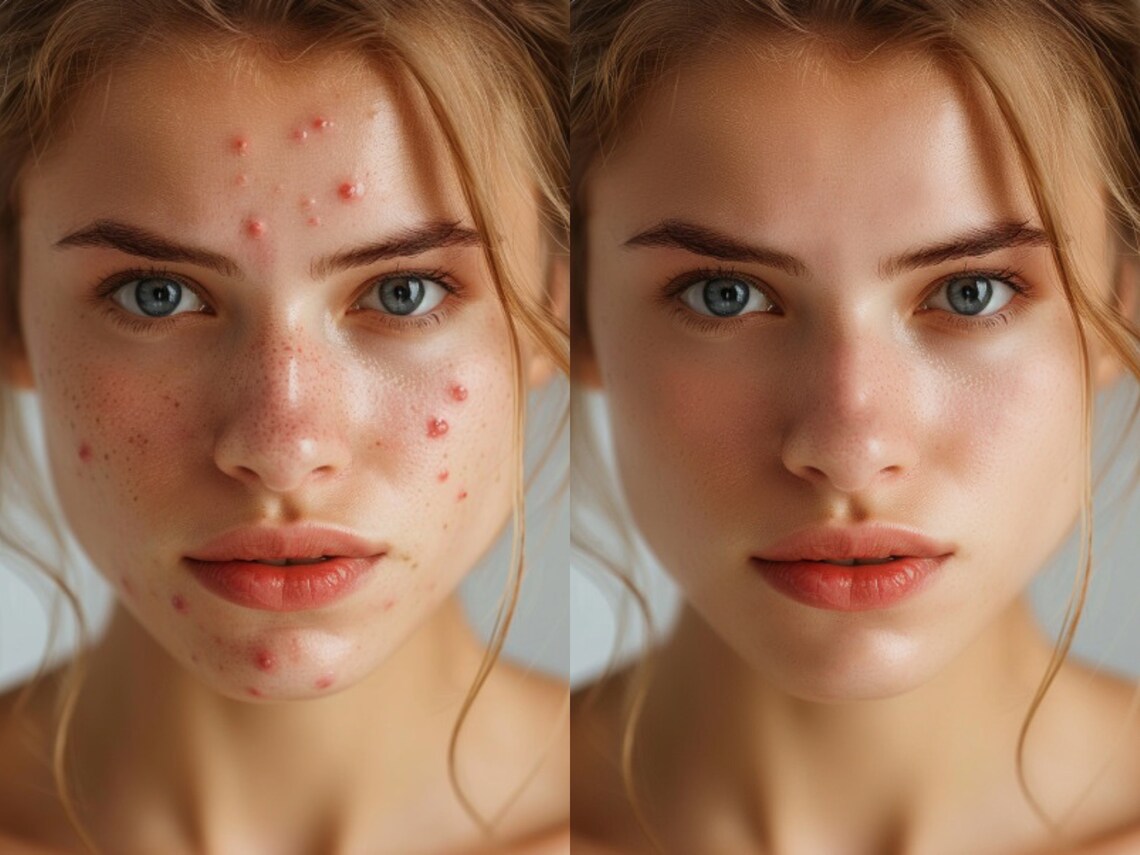 Photo Restoration, Custom Photo Editing, Photoshop Editing, Face ...