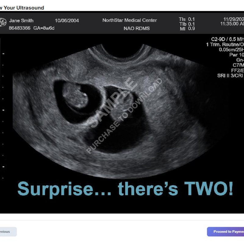 Baby Pregnancy Realistic - Etsy