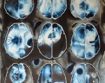 Brain Scan 14 Original Ink Painting on Yupo Neuroscience | Etsy