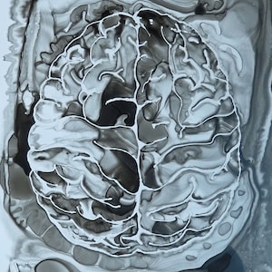 Big Brain - Original Ink Painting on Yupo - Neuroscience Art - Etsy