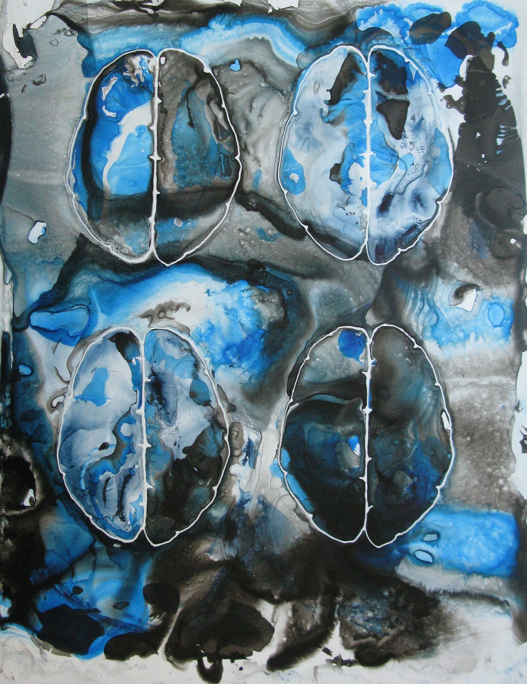 Brain Scan 7 - Original Ink Painting on Yupo - Neuroscience Art - Etsy