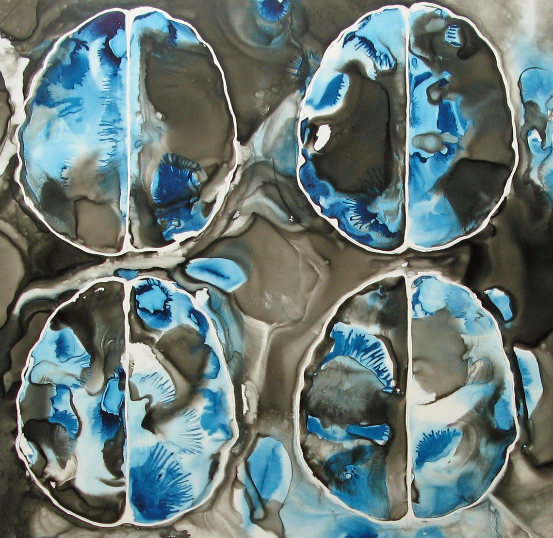 Brain Scan 14 Original Ink Painting on Yupo Neuroscience - Etsy