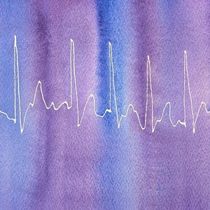Purple and Blue Atrial Fibrillation - Original Watercolor Ekg Painting ...