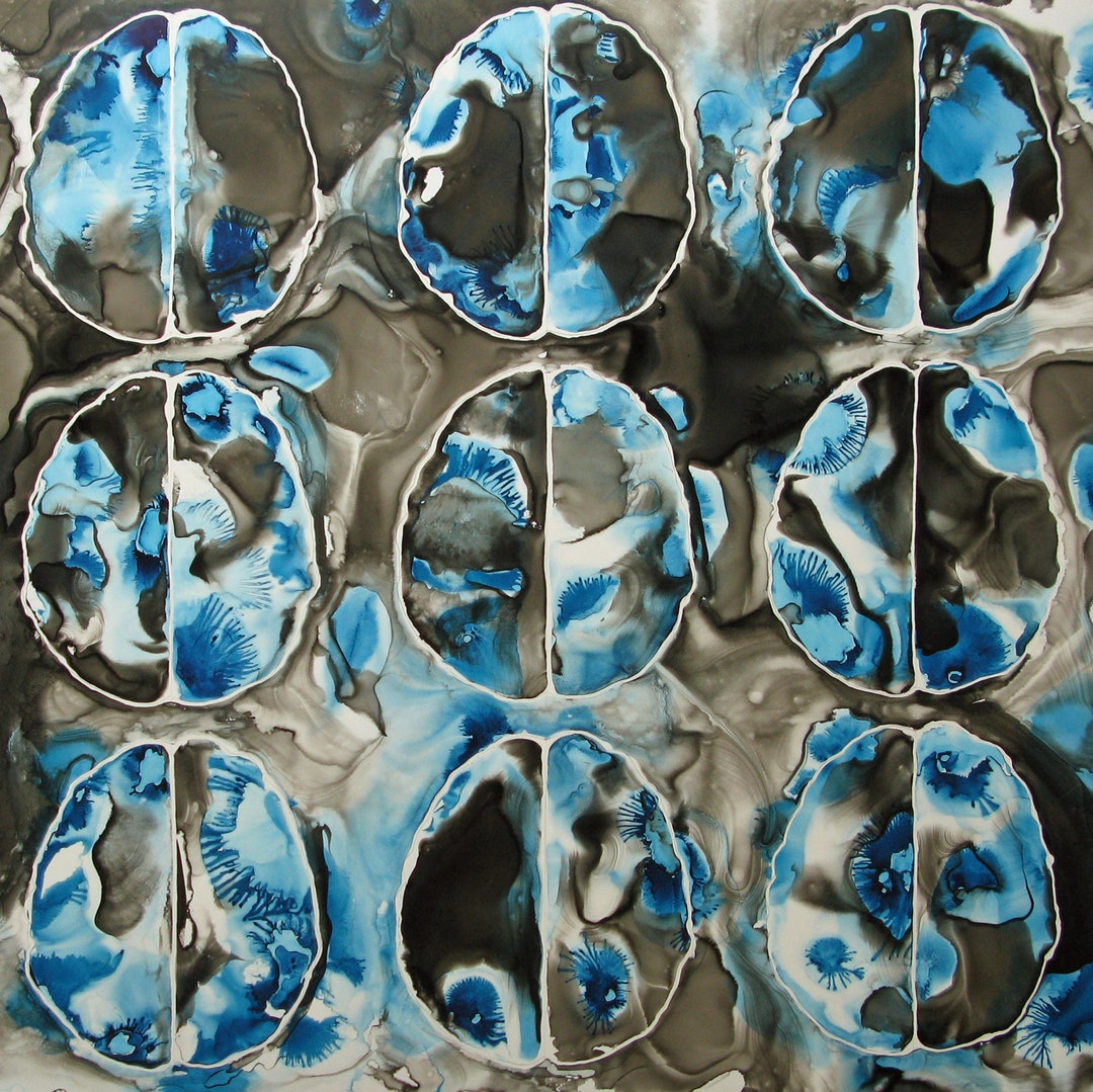 Brain Scan 14 - Original Ink Painting on Yupo - Neuroscience Art - Etsy