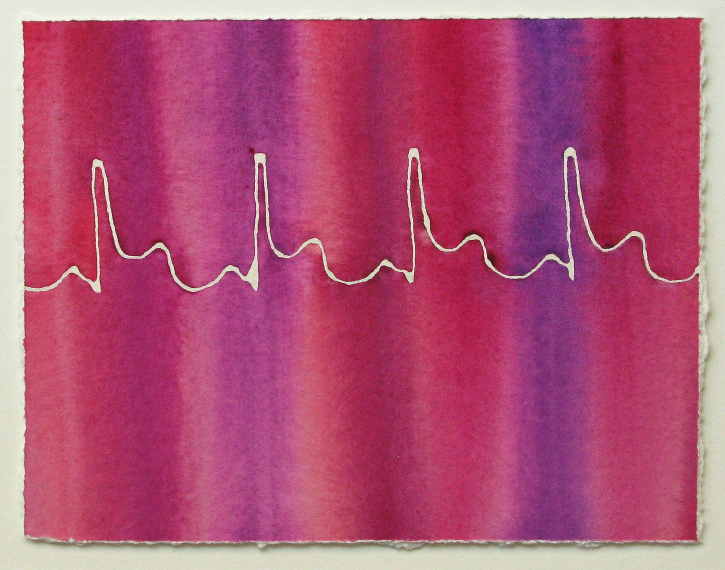 Pink Heart Attack Original Watercolor Ekg Painting - Etsy Australia