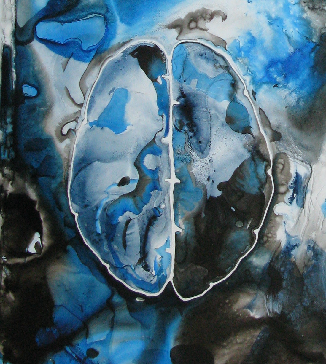 Brain Scan 7 Original Ink Painting on Yupo Neuroscience | Etsy