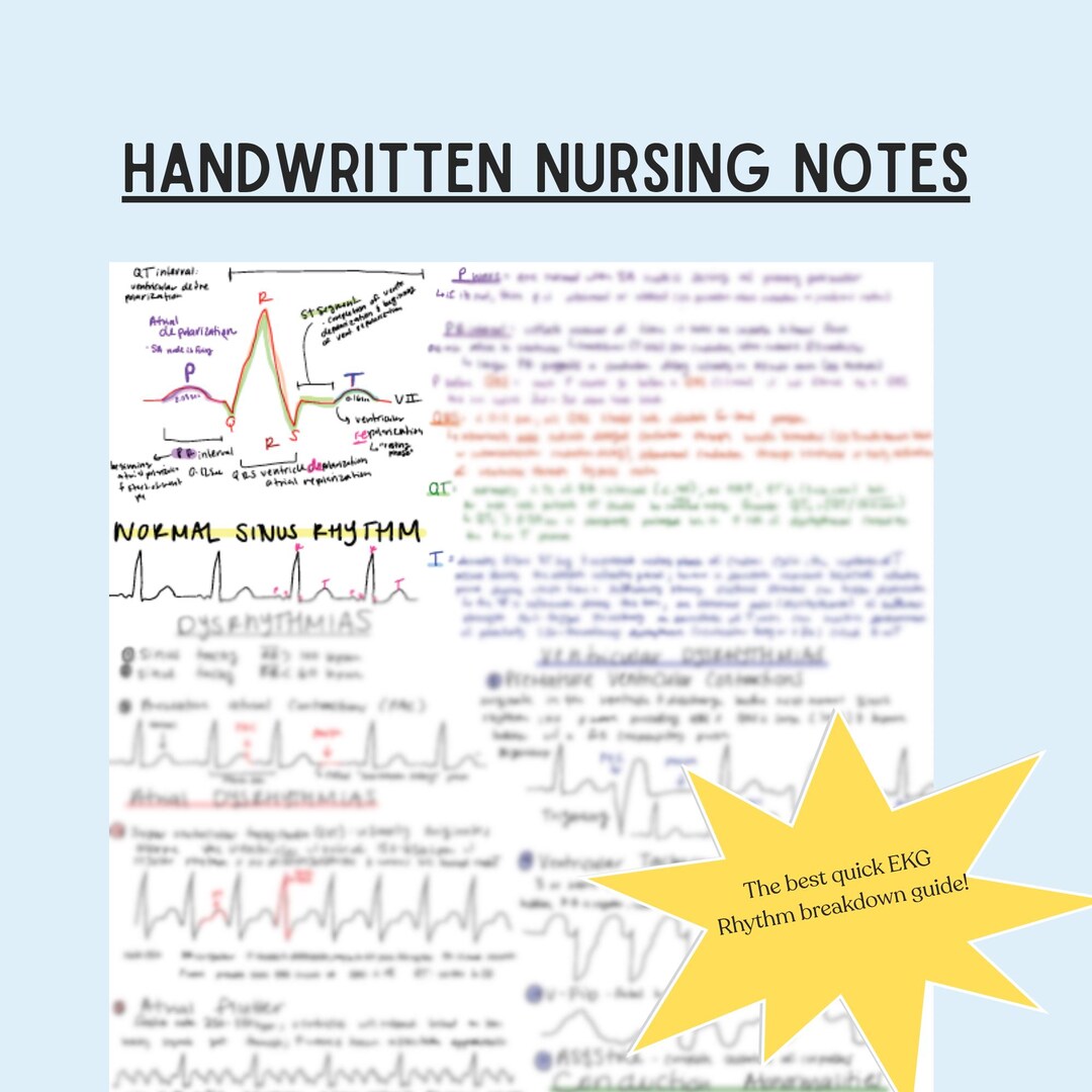 EKG Rhythm Cheat Sheet – Nursing Reference PDF | Handwritten, Visual ...