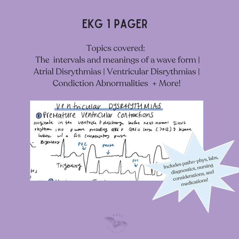 EKG Rhythm Cheat Sheet – Nursing Reference PDF | Handwritten, Visual ...
