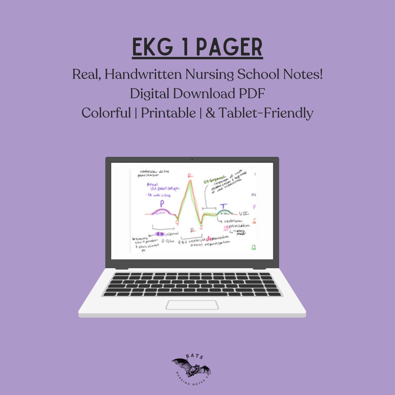 Buy EKG Rhythm Cheat Sheet – Nursing Reference PDF | Handwritten, Visual Quick Guide | NCLEX ...