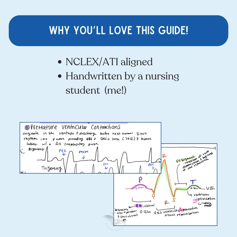EKG Rhythm Cheat Sheet – Nursing Reference PDF | Handwritten, Visual ...