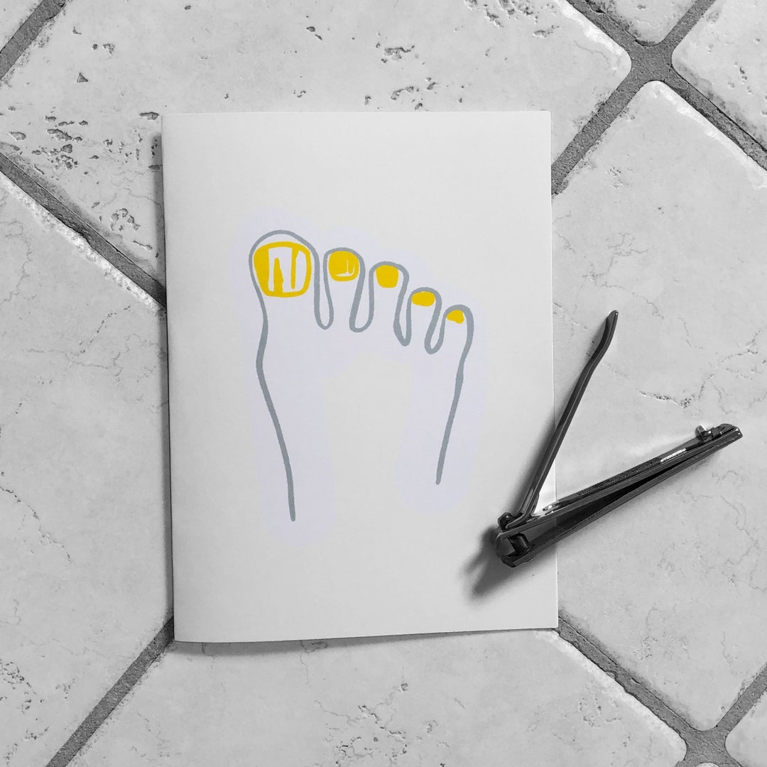 Yellow, Gnarly Toenails - What They Meant by "for Better or Worse ...