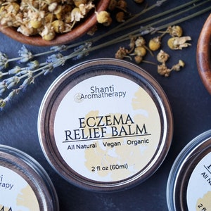 Soothing Balm for Dry and Irritated Skin - 2oz or 1/2 Oz Tin - Herbal ...