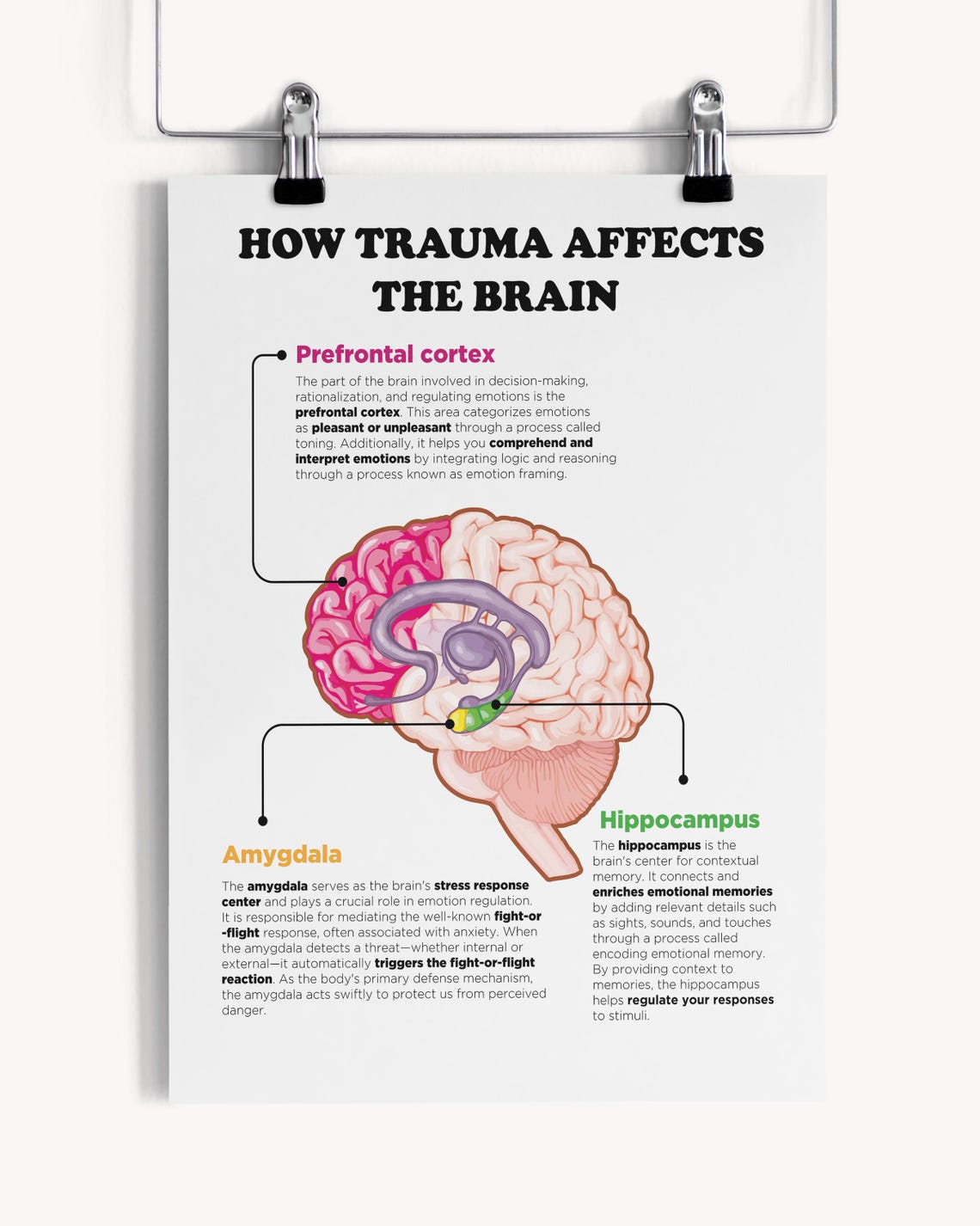 How Trauma Affects the Brain, Trauma and the Brain, Brain Anatomy ...