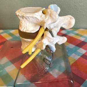 Vintage Western Germany Made Somso Medical Model Intervertebral Disc - Etsy