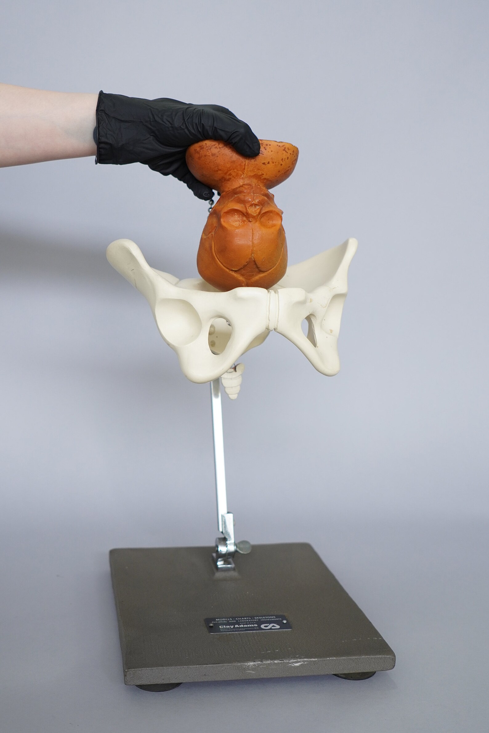 Vintage Clay Adams Pelvis and Fetus Model Demonstrator C. 1940 - Etsy