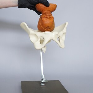Vintage Clay Adams Pelvis and Fetus Model Demonstrator C. 1940 - Etsy