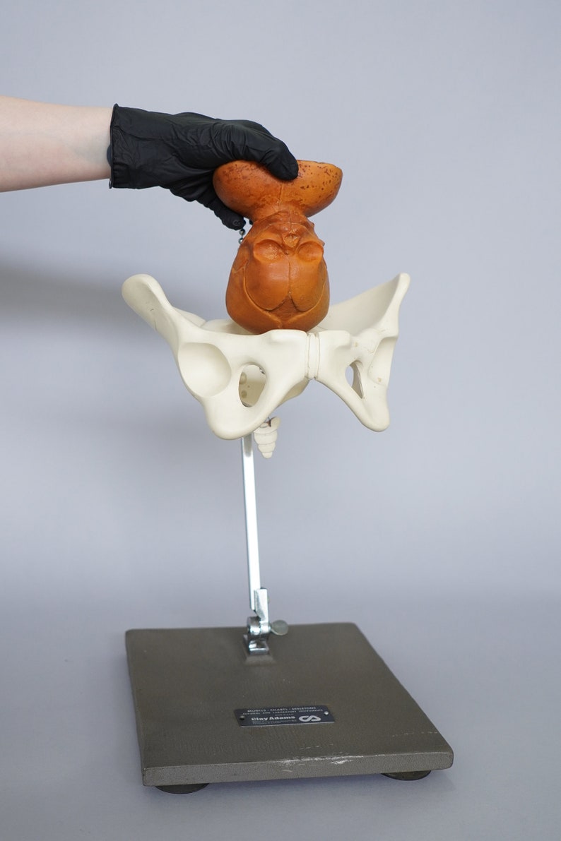 Vintage Clay Adams Pelvis and Fetus Model Demonstrator C. 1940 - Etsy
