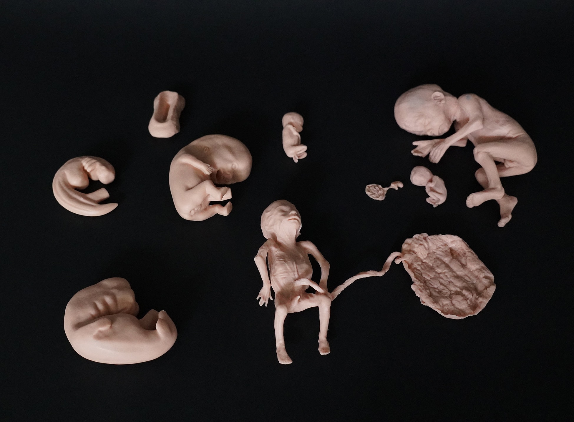 1970's Replica Life Forms Fetus Development With Case and Teaching ...
