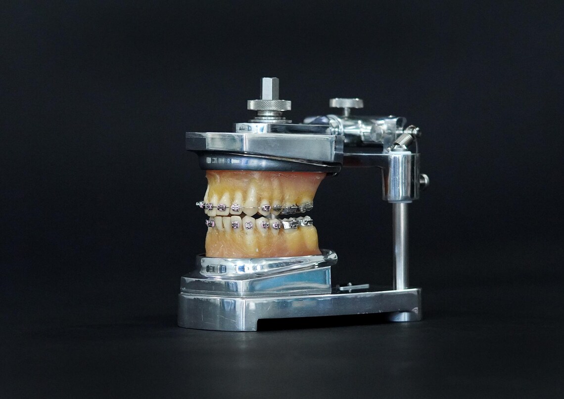 Vintage Orthodontic Articulator Dental Display Model - Etsy