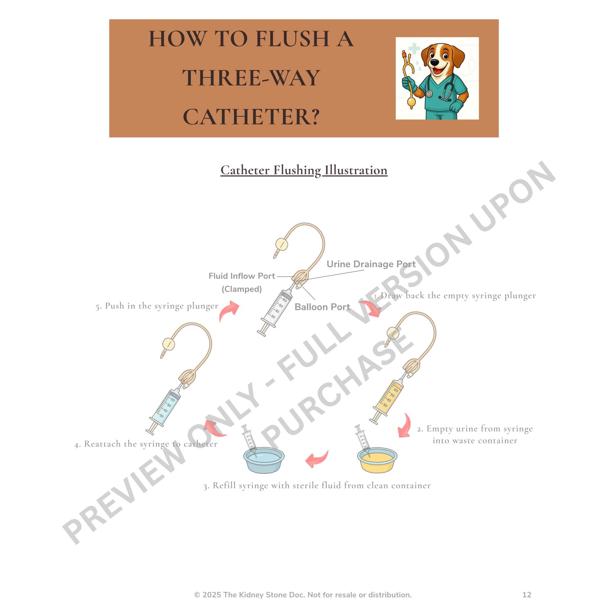 CBI Nurse Guide – Continuous Bladder Irrigation Instructions, Printable ...
