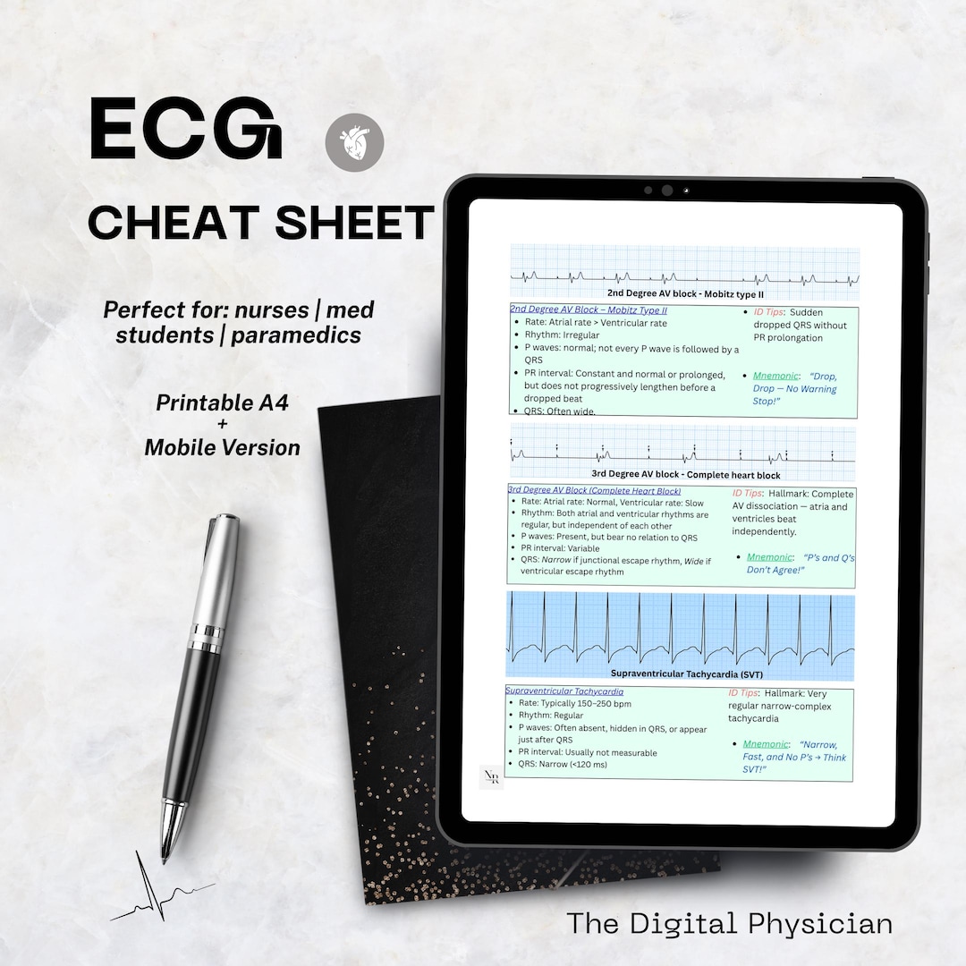ECG Interpretation Cheat Sheet | Cardiac Rhythms Guide (printable A4 ...