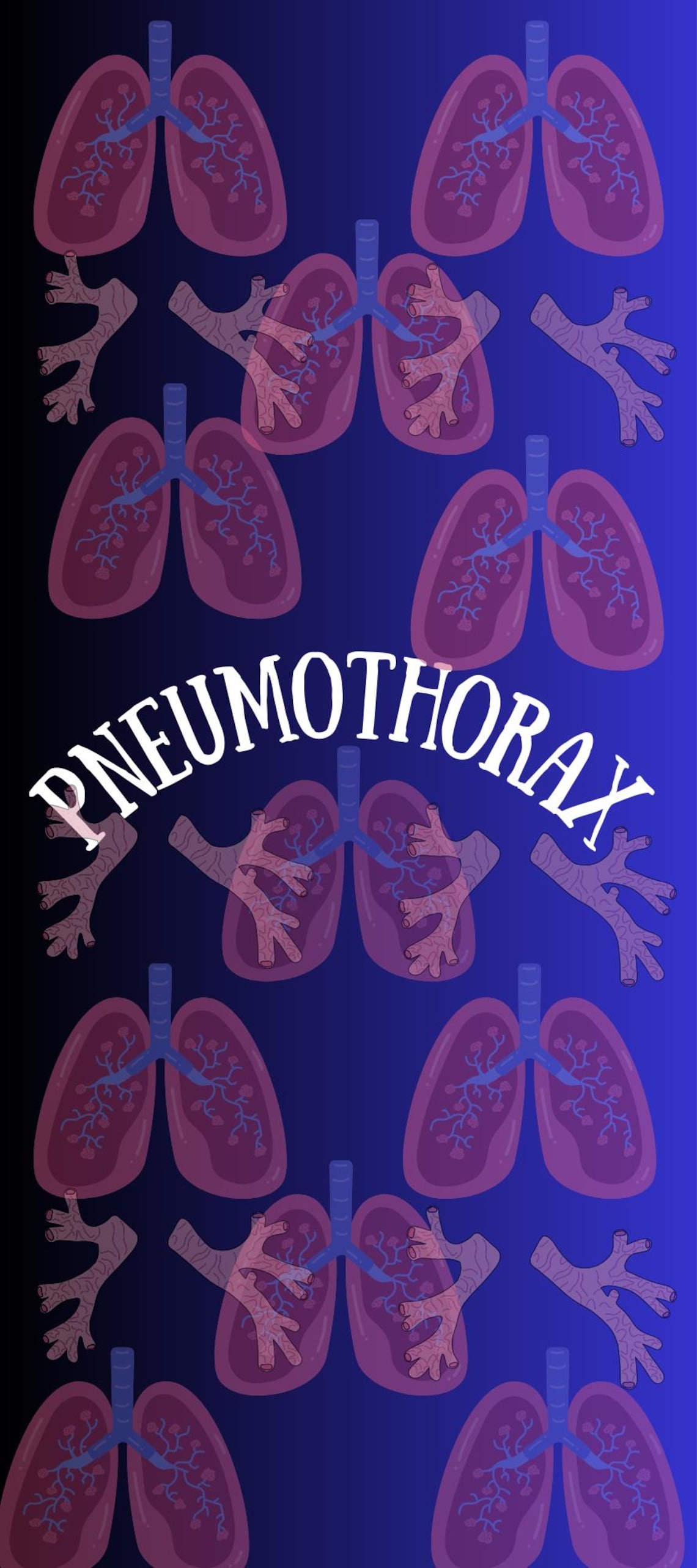 Pneumothorax Infographic: Types, Patho, Risk Factors & Treatments - Etsy