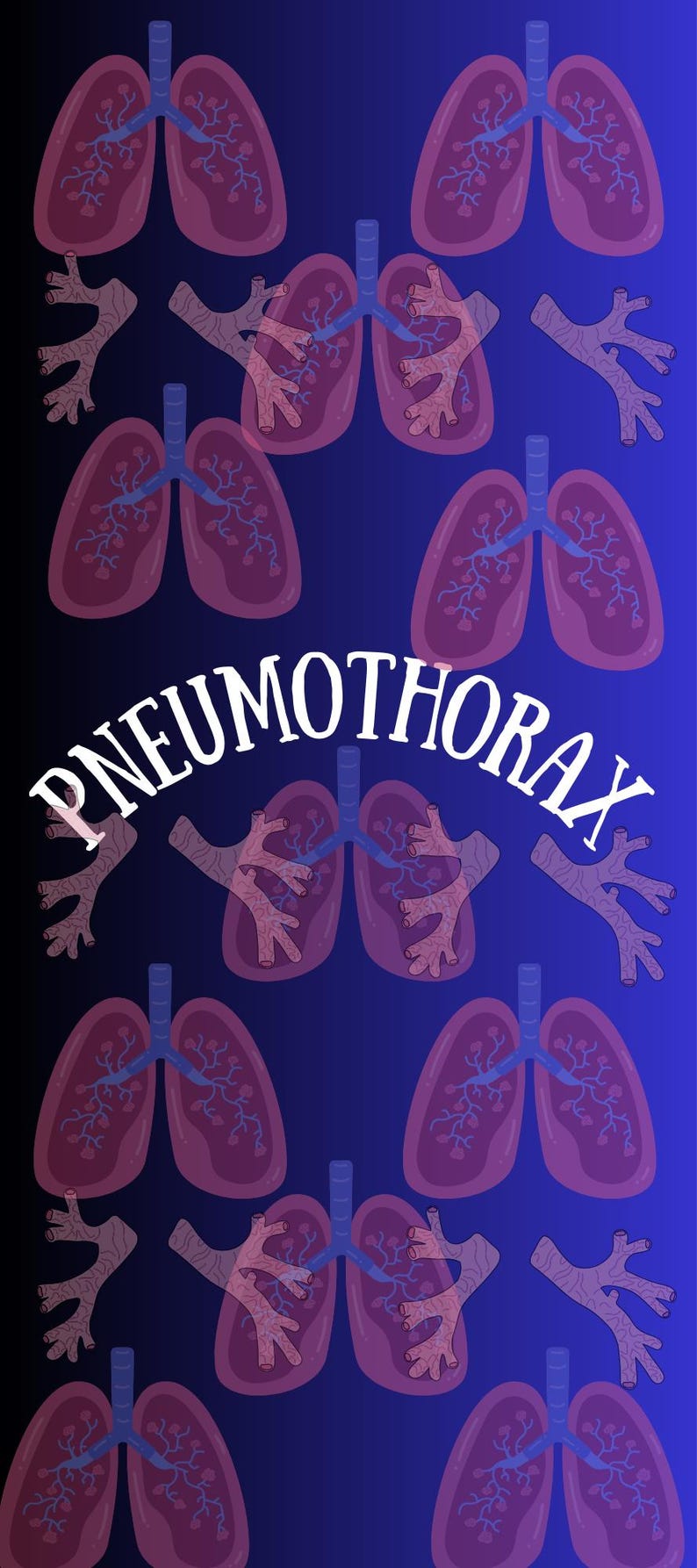 Pneumothorax Infographic: Types, Patho, Risk Factors & Treatments - Etsy