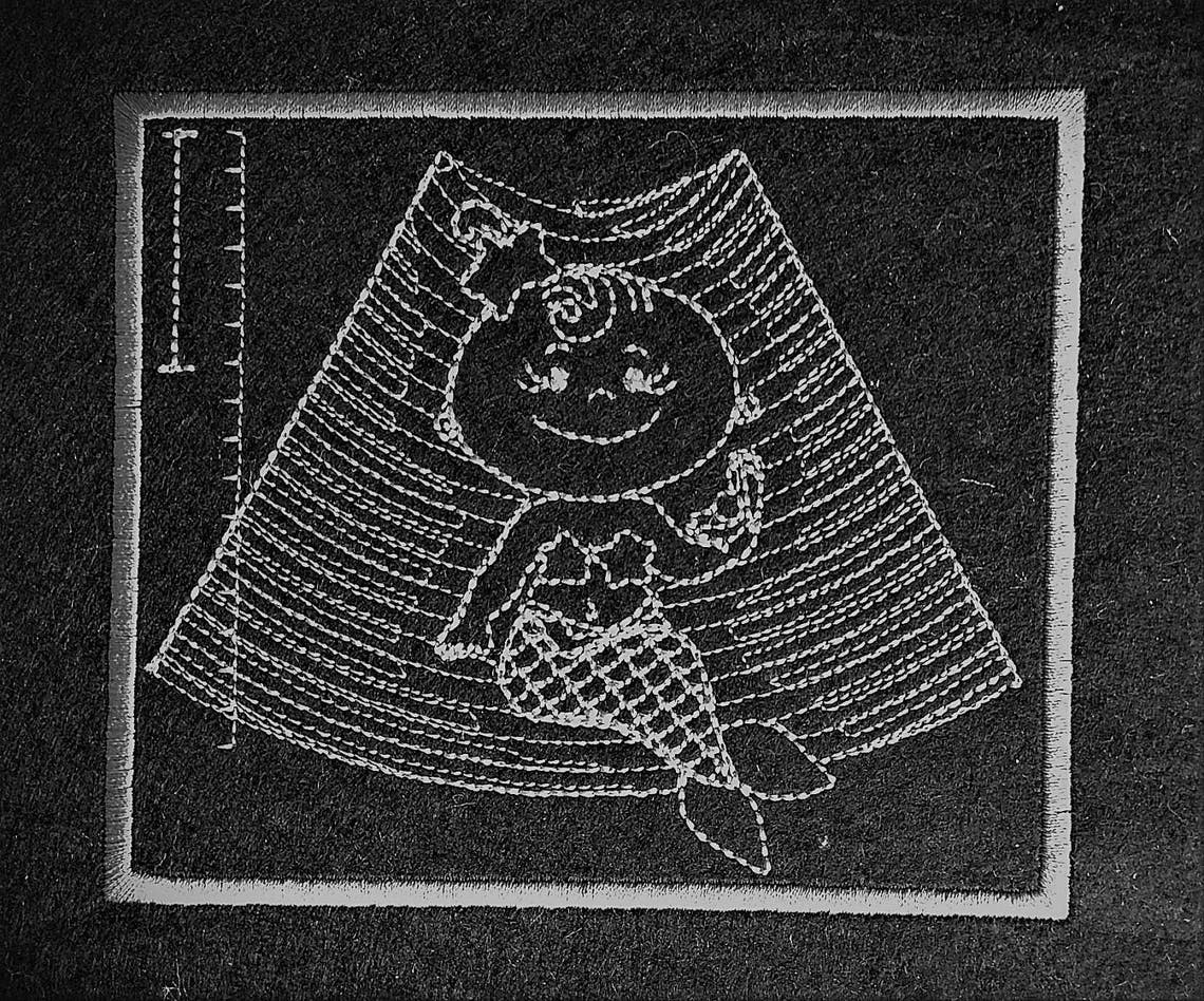 Mermaid Ultrasound Tech Baby Girl Photo Machine Embroidery | Etsy